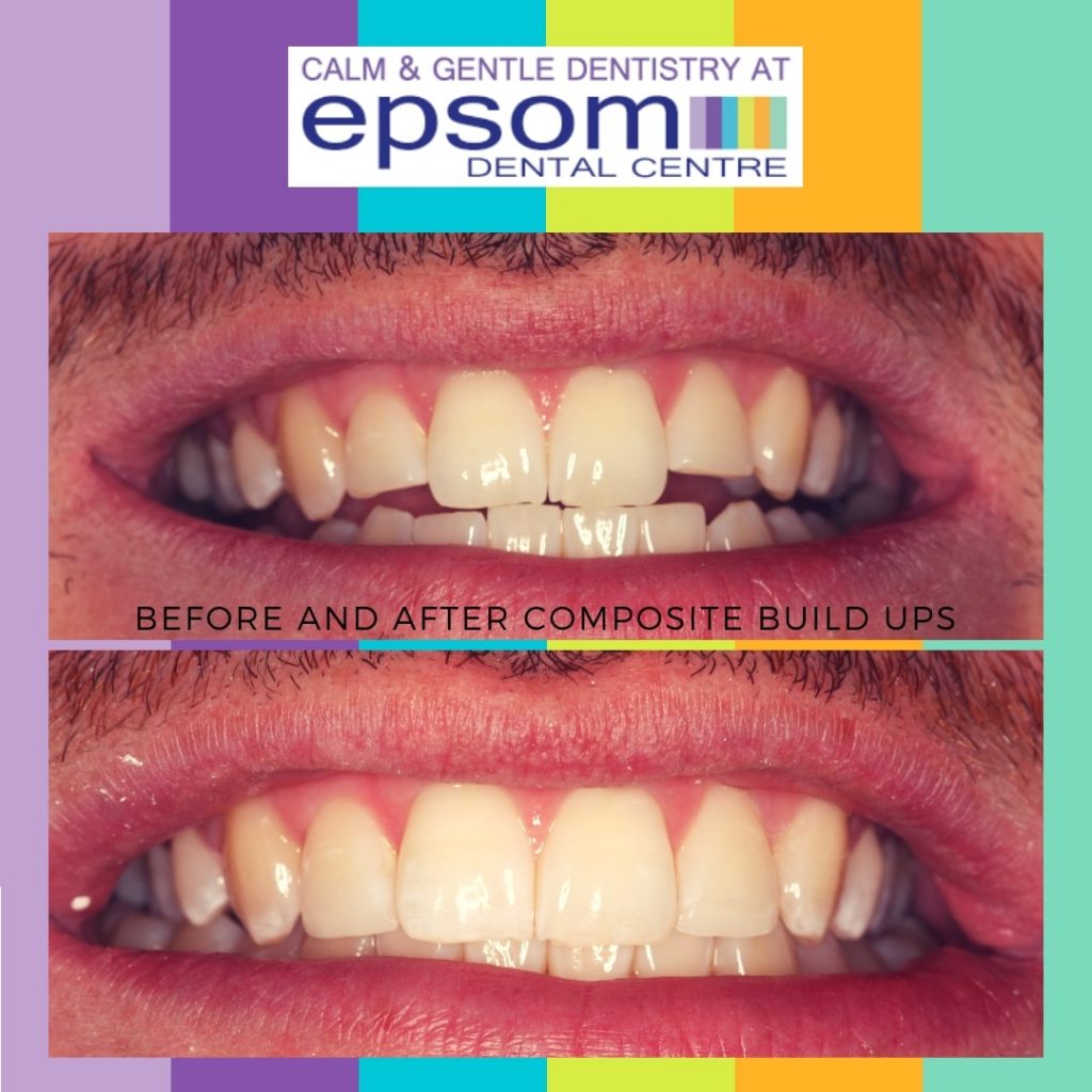Success Stories - Epsom Dental Centre